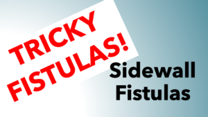 Help Center – Complex Wounds and Fistulas